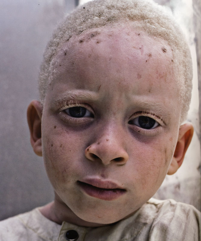 Niño negro albino | Edición impresa | EL PAÍS