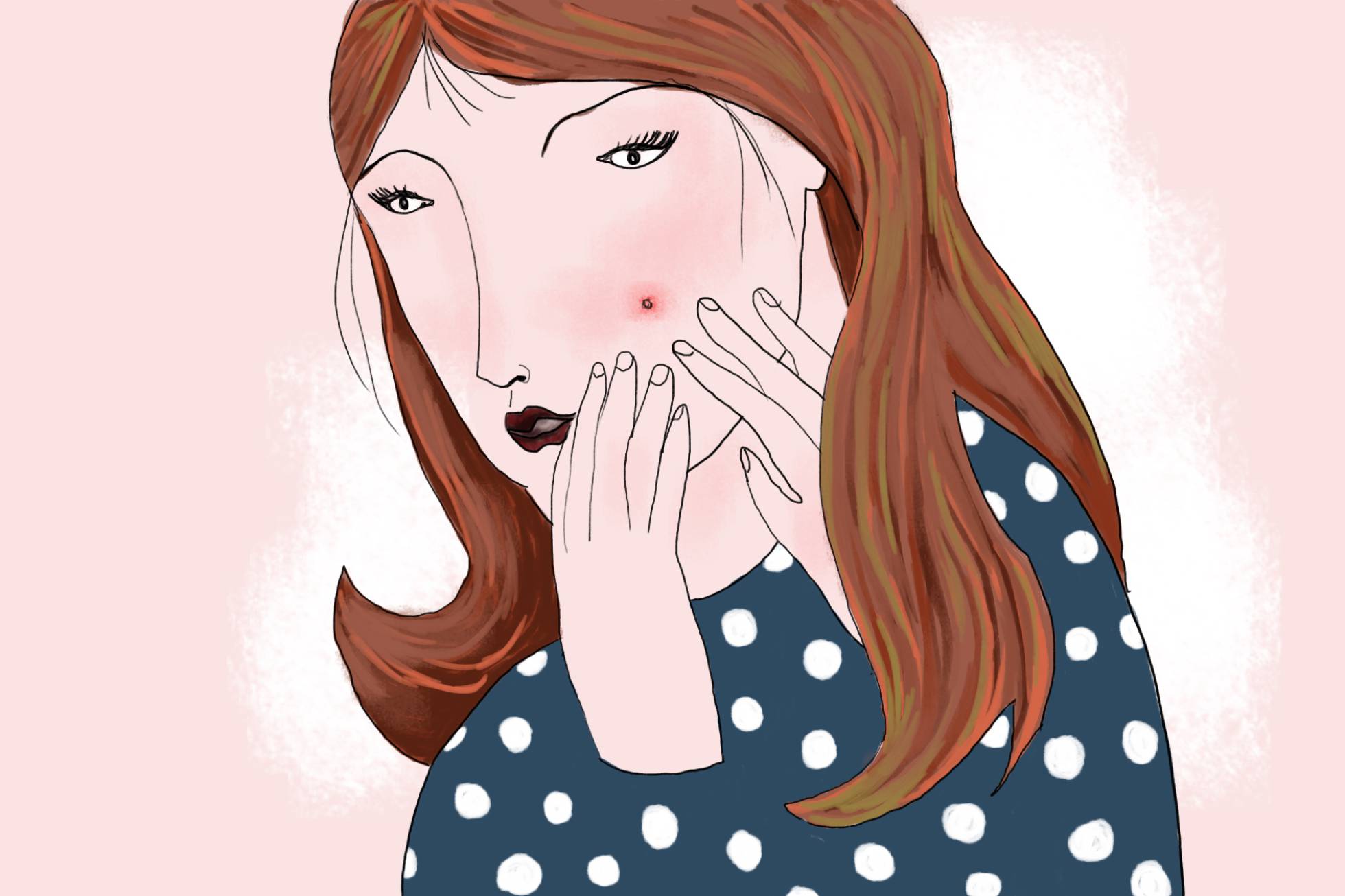 Fotorrelato: Los seis tipos de granos que distinguen los dermatólogos y ...